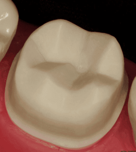 Dental Education Videos | Stevenson Dental Solutions