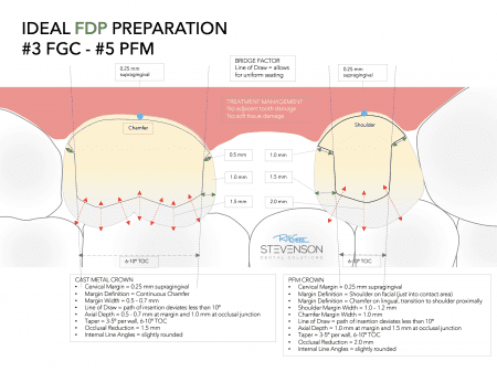 2-Day ADEX/CDCA Dental Course: Fixed Prosthodontics