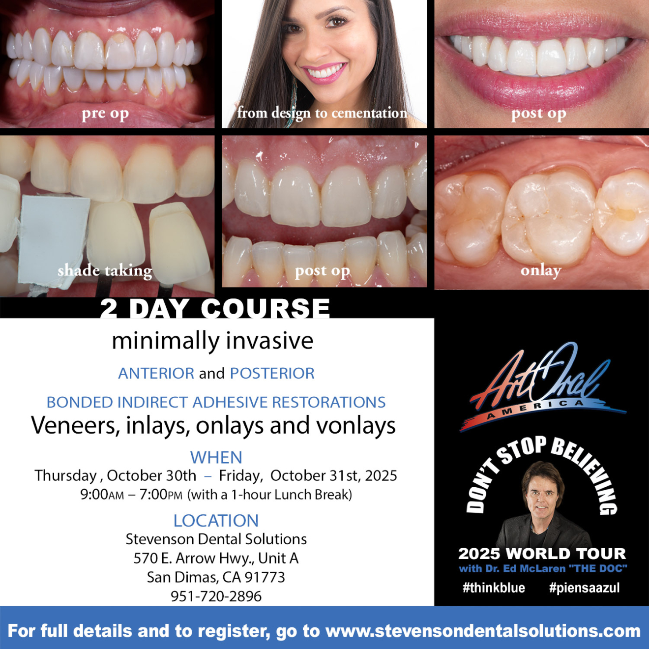 Minimally Invasive Anterior and Posterior Bonded Restorations: Veneers ...